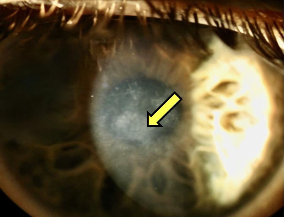 To Make a Smart Decision, You Need to Understand Epithelium-On versus ...