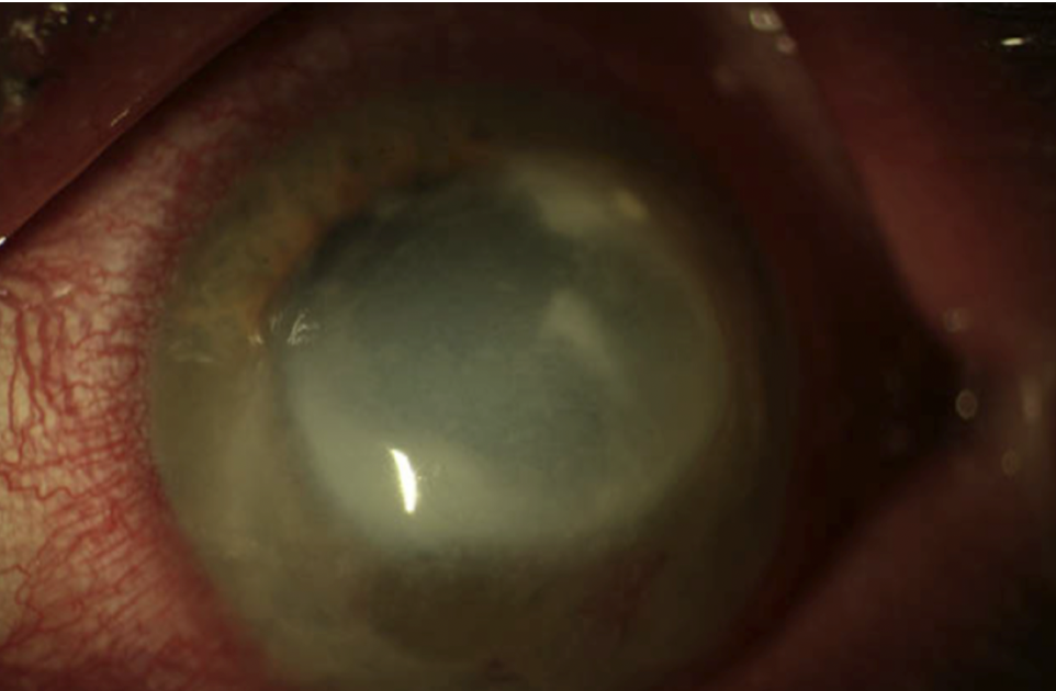 To Make a Smart Decision, You Need to Understand Epithelium-On versus ...